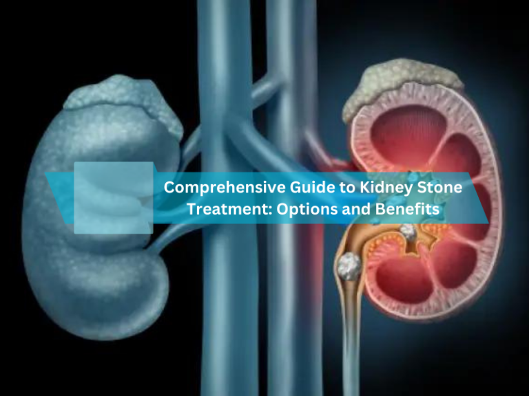 Comprehensive Guide to Kidney Stone Treatment: Options and Benefits ...
